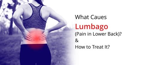What Is Lumbago Causes Symptoms And How Is It Treated