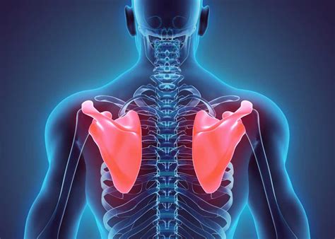 Scapulothoracic Bursitis