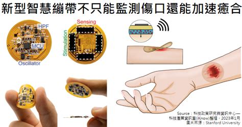 市場報導 ： 新型智慧繃帶不只能監測傷口還能加速癒合 科技產業資訊室iknow