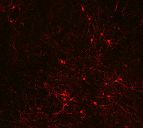 Segmentation Of Somas From Oblongated Cells · Issue 394 · Mouseland