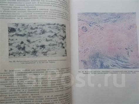 Атлас клетки, Патологическая анатомия 1954г - 5 книг одним лотом, б/у ...