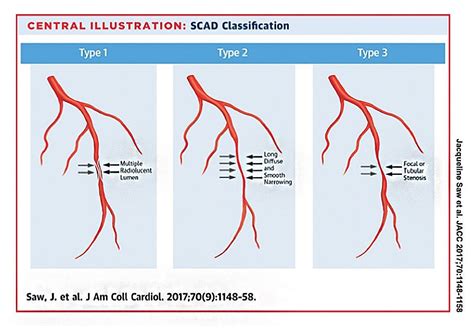 Copy Of What Is Scad — Scad Bc