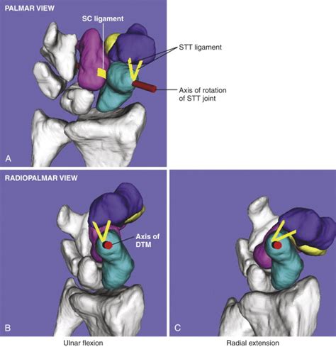The Kinematics And Clinical Implications Of The Dart Throwing Motion