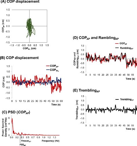Figure 21 From The Effects Of Aging On Multiple Postural Muscle Control And Postural Sway