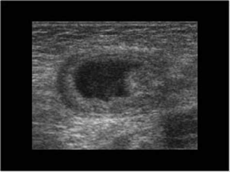 Pediatrics 9 1 Pediatric Abdomen And Retroperitoneum Case 9 1 10