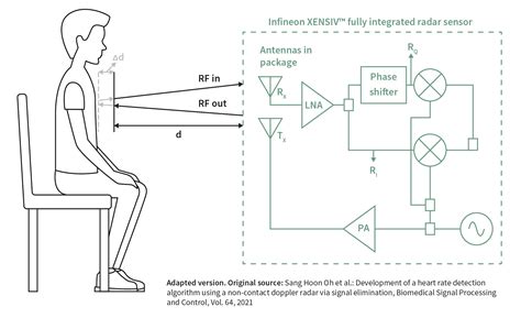 delivering contactless health monitoring through radar sensors