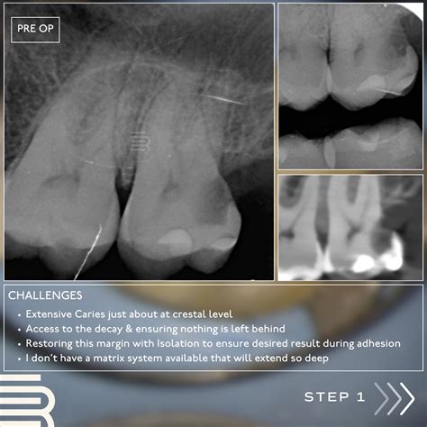 Shaurya S Bds Pgdip Endo Mclindent Endo M Endo Rcsed Not Sure