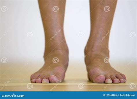 Woman Bare Feet On The Floor Legs Care And Skin Treatment Concept