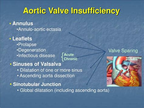 Ppt Aortic Valve Disease Powerpoint Presentation Free Download Id