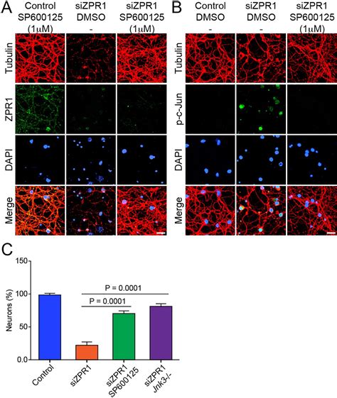 ZPR1 Dependent Neurodegeneration Is Mediated By The JNK Signaling