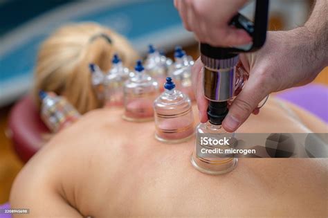 물리 치료 세션 중 등에 부항 치료를 받고 있는 여성 흡입 컵은 혈액 순환을 개선하고 근육 긴장을 완화하며 통증 완화를 위한 치유를 촉진하기 위해 적용됩니다 2명에 대한