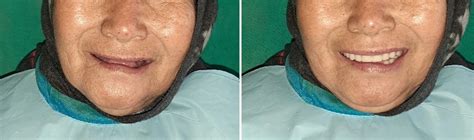 Online Open Access Dental Magazine Journal Publication Dentistry Journal