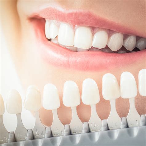 Cosmetic Teeth Whitening Safaa Aesthetic Academy