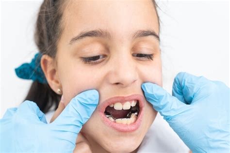 Overlapped Teeth Causes And Treatment North Dekalb Orthodontics