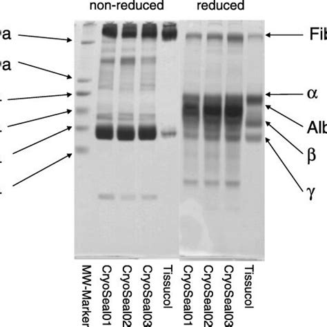 Sodium Dodecyl Sulphatepolyacrylamide Gel Electrophoresis Sdspage