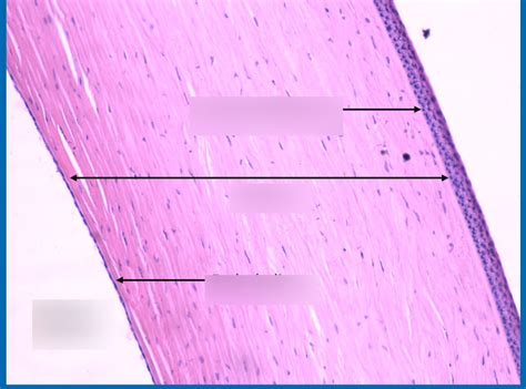 Cornea Diagram Quizlet