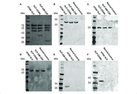 Characterization Of Purified Vlps Using Sds Page And Western Blot