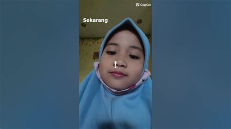 Kok Ada Yang Aneh🤭🤫 Youtube