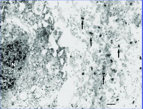 E Pta Stained Synaptic Junctions From The Cerebral Cortex Of An Adult