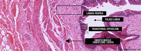 Ureter Slide Labelled Histology Schoolworkhelper