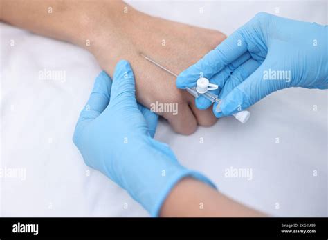 Nurse Inputting Catheter For Iv Drip In Patient Hand Closeup Stock