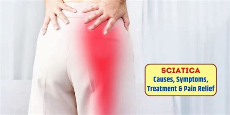 Sciatica What It Is Causes Symptoms Treatment And Pain Relief