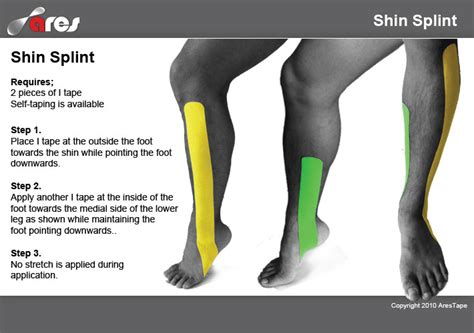Leg Wraps For Shin Splints At Malinda Nugent Blog