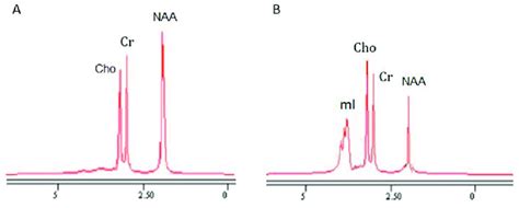 Examples Of Magnetic Resonance Spectroscopy Mrs Spectra In Java Based