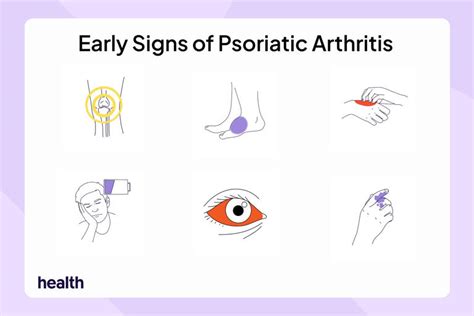 Early Signs And Symptoms Of Psoriatic Arthritis Psa