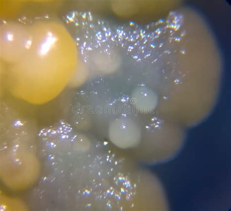 Microscopy Of A Smooth Round Bacterial Colonies Stock Image Image Of Colony Dish 178383141