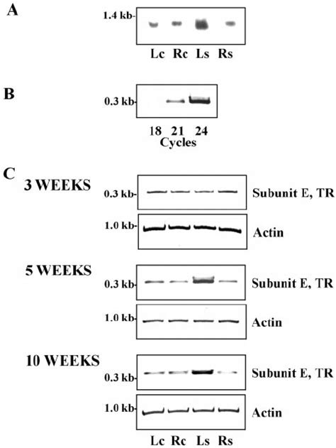 Tissue Specific Differences In Transcript Accumulation Of V Atpase