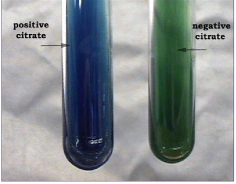 Citrate Test Flashcards Quizlet