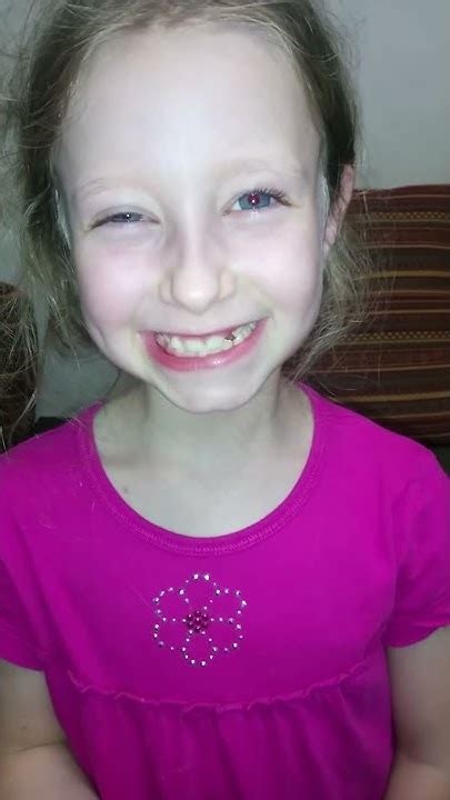 נפלה לי שן Youtube