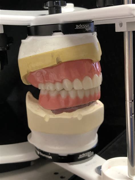 Hybrid Prosthesis Bandb Dental Ceramic Arts
