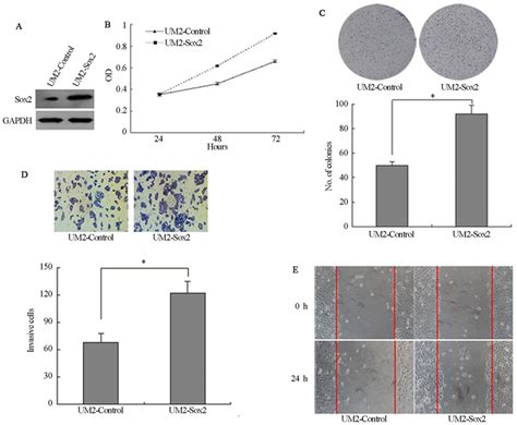 Ability Of Cell Proliferation Migration And Invasion In Download