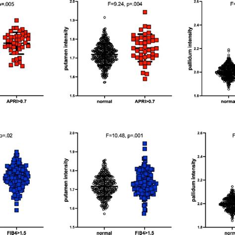 Basal Ganglia Signal Intensities By Apri Red Top Or Fib4 Blue