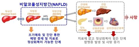간 섬유화 발생 위험 지방화된 근육량 많을수록 2 8배↑