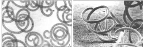 Morphology Of Spirulina A Optical Microscopy Of Axenic S