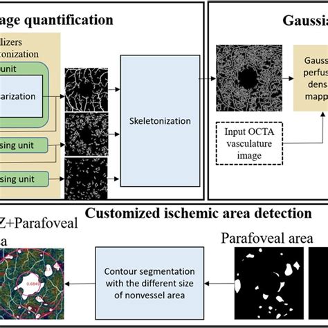 flowchart of the proposed automatic octa image analysis algorithm