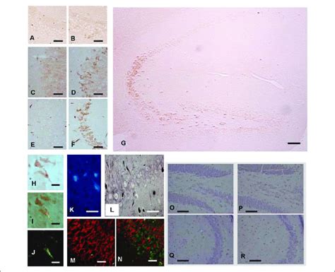 Histochemical And Histopathological Assessment Of Brain Sections From