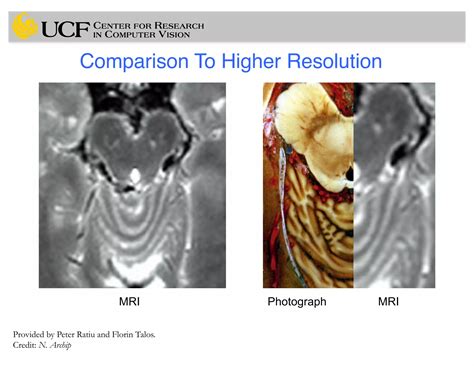 Lec14 Evaluation Framework For Medical Image Segmentation Ppt