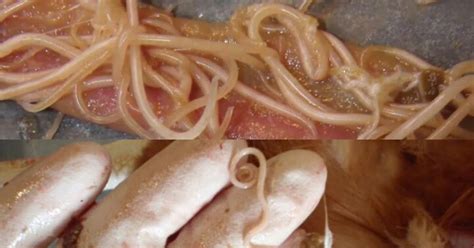 Intestinal Worms Symptoms And Causes