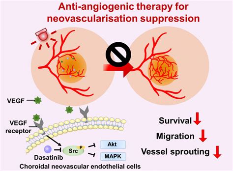 Hkumed Achieves Breakthrough In Photoactivatable Nanomedicine For The Treatment Of Age Related