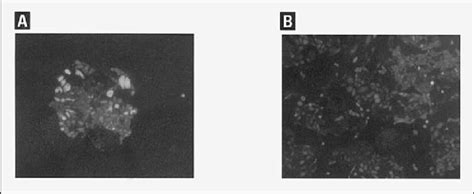 Fluorescence Microscopy Of A Green Fluorescent Colony And Propagated