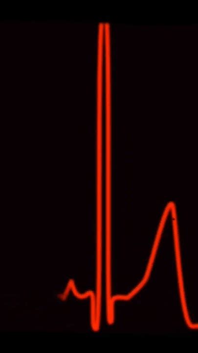 Fast Heartbeat Sound Effect Youtube