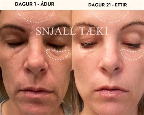 Mini Ems Nuddtæki Snjall Tæki