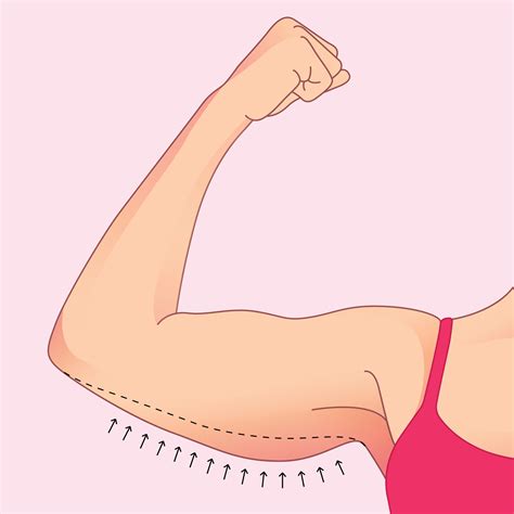 Upper Arm Fat Brachioplasty Liposuction Or Plastic Surgery Woman
