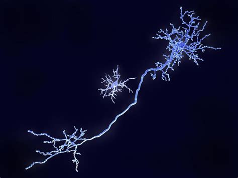 Osteopontin May Play Key Role In Alzheimers Disease Emilia Julia Damian