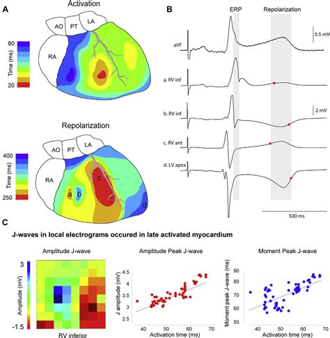 Early Local Repolarization Does Not Coincide With The Early Download Scientific Diagram
