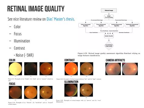 Shallow Introduction For Deep Learning Retinal Image Analysis PDF Eye And Vision Conditions